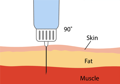 Injectables 101: You Asked, We Answered | AgelessRx