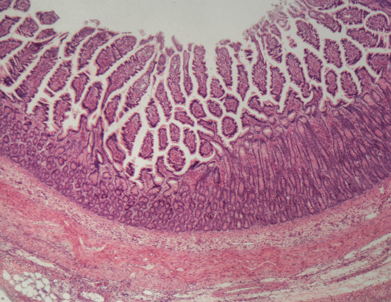 Microdosing GLP-1 and Inflammation: A New Longevity Strategy | AgelessRx