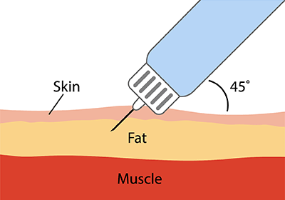 Injectables 101: You Asked, We Answered | AgelessRx