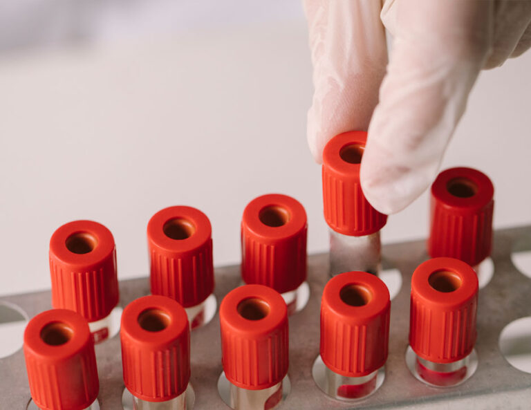 Why Accurate eGFR Readings Matter for Kidney Health | AgelessRx Why Accurate eGFR Readings Matter for Kidney Health | AgelessRx